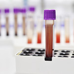 BloodLine | Continuing Medical Education for Hematology